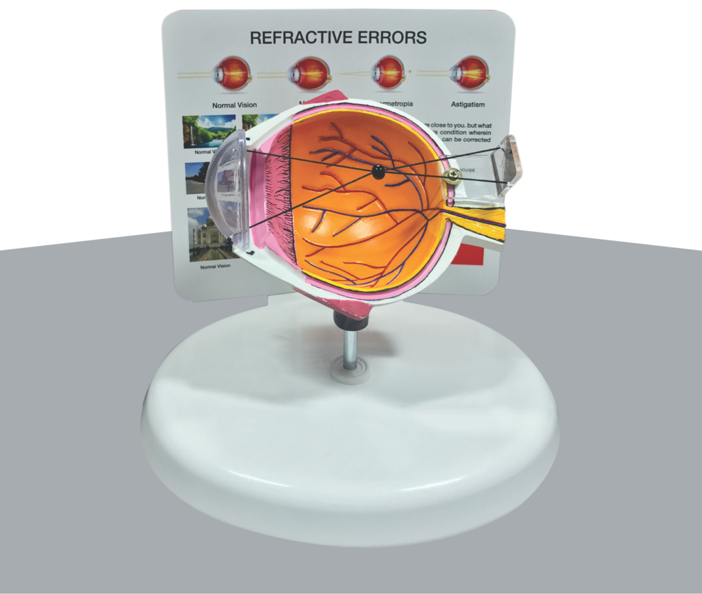 Refractive Eye Model – MSA Ophthalmic Group