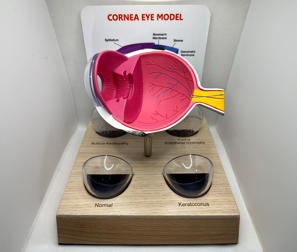Cornea Eye Model – MSA Ophthalmic Group